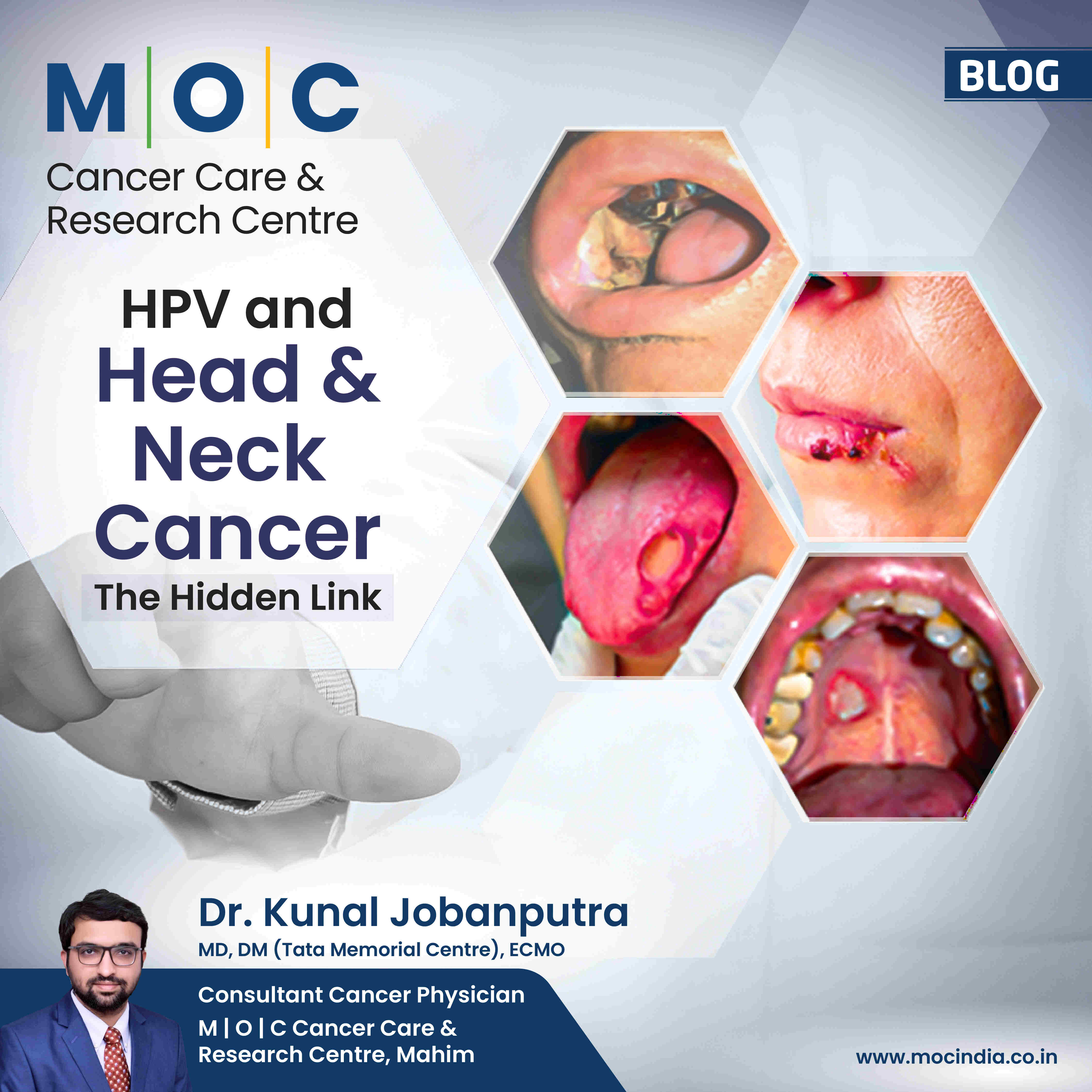 HPV and Head & Neck Cancers: The Hidden Link