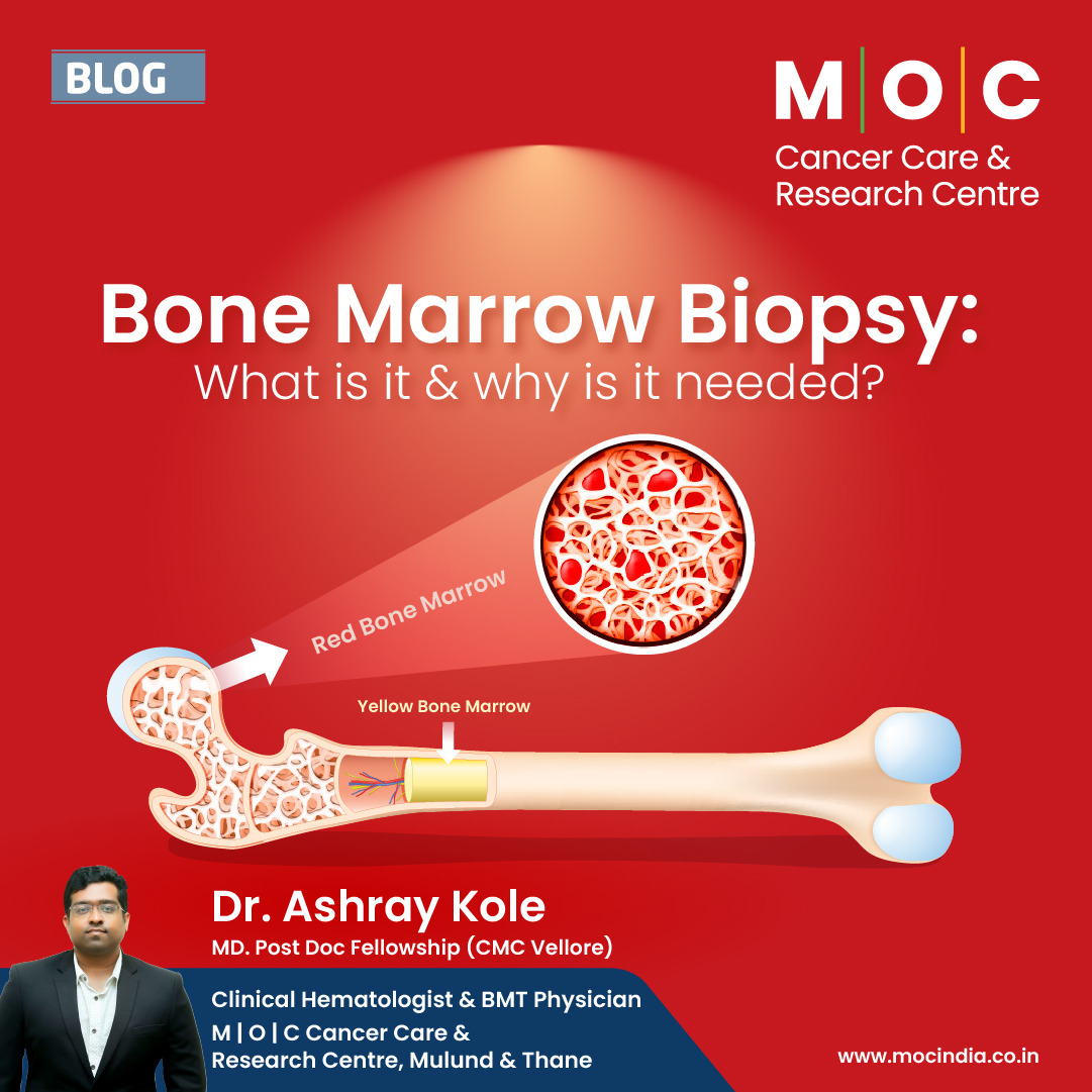 Bone Marrow Biopsy: What It Is, Procedure, and Why It's Needed