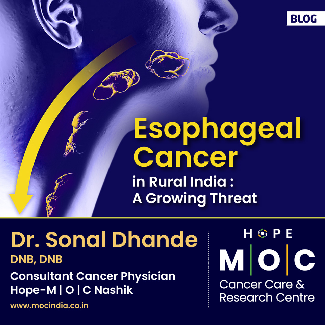 Esophageal Cancer in Rural India: A Rising Threat