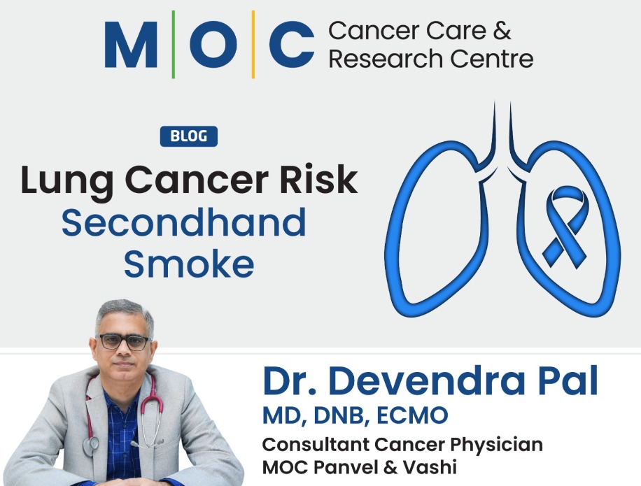 Secondhand Smoke and Lung Cancer Risk | M | O | C Cancer Care ...